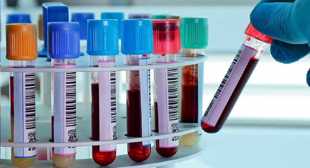 ℹ Tipos de pruebas de laboratorio más comunes